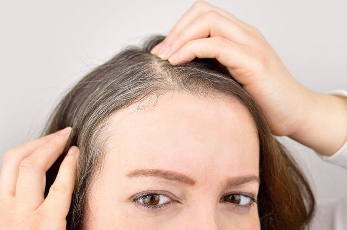 Kenapa Uban Ada di Usia Muda, Penyebabnya Berasal dari Ini - Stylo