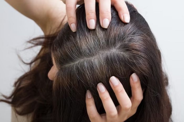 2 Rekomendasi Bahan Dapur untuk Menghilangkan Uban, Dijamin Rambut Menghitam dalam Hitungan ...