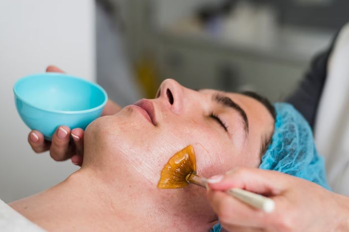 Muka Bopeng Bekas Jerawat, Ini 3 Cara Mengatasi yang Bisa Kamu Coba ...