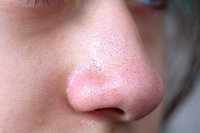 5 Skincare Buat Hilangkan Komedo yang Susah Hilang. Harus Rajin Pakai ...