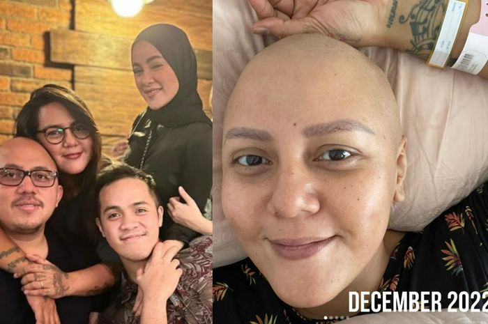 Cinta Ramlan Pilu Idap Kanker Ganas, Adik Olla Ramlan Kini Tampil Botak ...