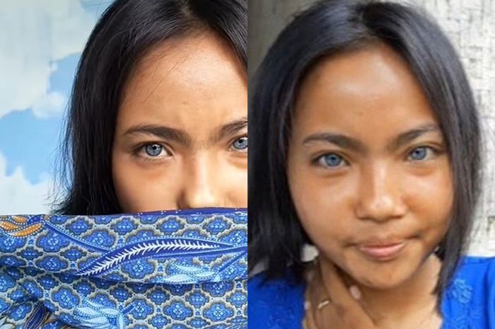 Gadis Sunda Bermata Biru Viral, Asal Usul Mata Indahnya Ternyata ... Gadis Sunda Bermata Biru Viral, Asal Usul Mata Indahnya Ternyata ...