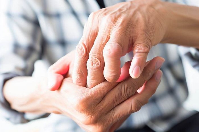 Gejala-gejala Awal Asam Urat, Kenali Langsung dan Segera Bertindak ...