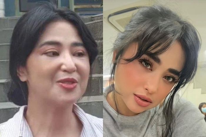 Dewi Perssik Muncul dengan Wajah Bengkak, Ini Kata Sang Pedangdut Soal ...
