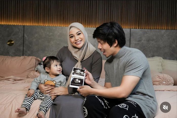 Selamat! Aurel Hermansyah Hamil Anak Kedua, Bagikan Potret USG - Nova