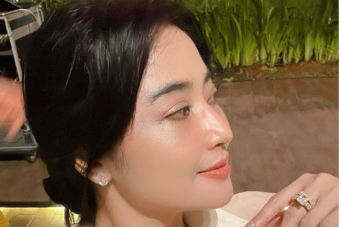 Dewi Perssik Malih Rupa Dengan Operasi Transfer Lemak, Apa Itu dan ...