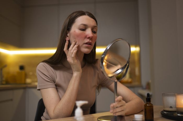 Apa Bedanya Jerawat Pustula dan Jerawat Biasa? Beda Perawatan! - Stylo