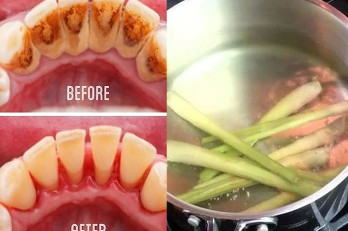 Sampai Ditelepon Dokter Gigi Langganan Kok Gak Pernah Datang Lagi ...