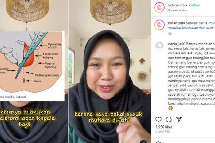 'Ini Tadi Saya Gunting Loh', Bidan Sampai Syok Tahu Pasien Melahirkan Pakai Susuk, Luka Sayat ...