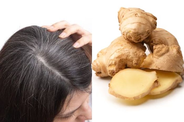 Minder Ada Uban di Kepala? Coba Lenyapkan Pakai Sepotong Jahe dengan Cara ini, Dijamin Rambut ...