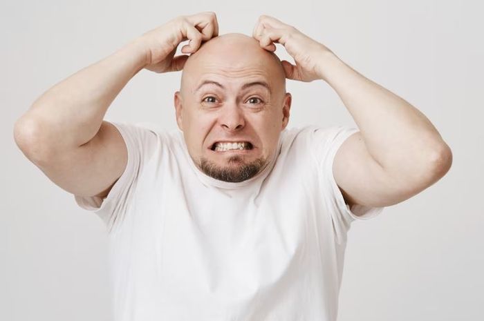 5 Arti Mimpi Botak, Bawa Sial Buat Pemimpinya, Tabungan Bisa Ludes ...