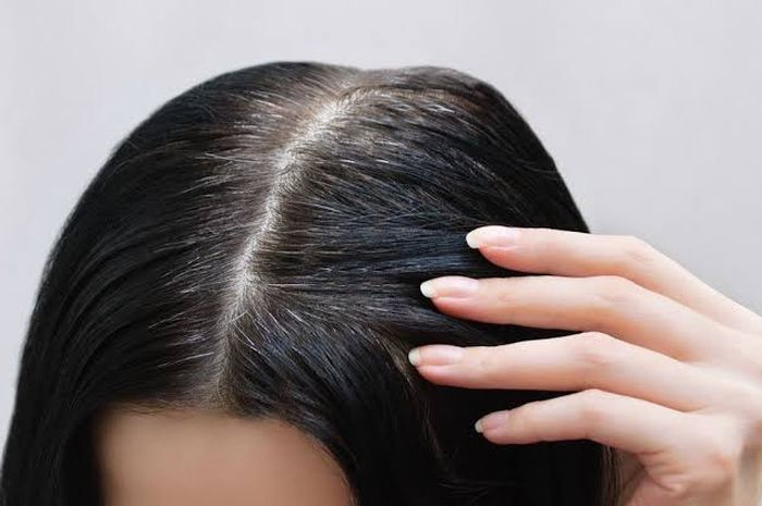 Kenapa Muncul Uban di Usia Muda? Ini Penyebabnya Wajib Tahu! - Stylo