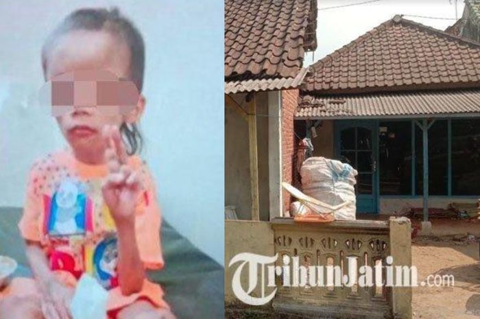 Derita Bocah 7 Tahun di Malang, Disiksa Keluarga hingga Alami Busung Lapar, Sering Digebuki ...