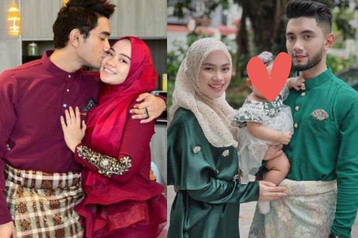 Anaknya Terlahir dengan Bibir Sumbing dan Cacat Jari, Pasangan Artis ...