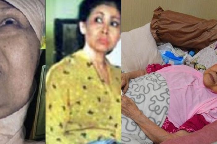 Makanan Penyebab Glaukoma yang Menyebabkan Aminah Cendrakasih 'Mak Nyak ...