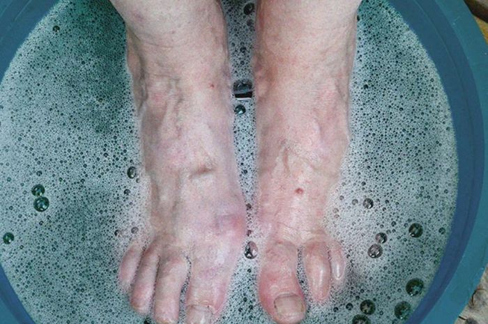 Baru Coba Rendam Kaki Dalam Baking Soda Sebelum Tidur, Paginya Syok ...