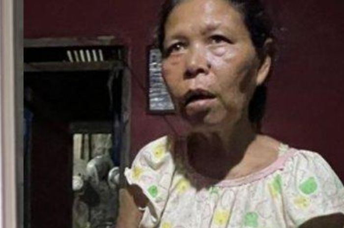 Wanita Paruh Baya di Bogor Ditusuk Pemuda Mabuk Berkali-kali, Pisau sampai Patah tapi Korban Tak ...