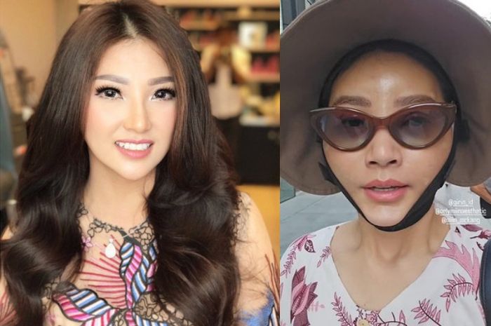 Sarwendah Oplas Wajah di Korea Usai Digugat Cerai Ruben Onsu, Sang ... Sarwendah Oplas Wajah di Korea Usai Digugat Cerai Ruben Onsu, Sang ...
