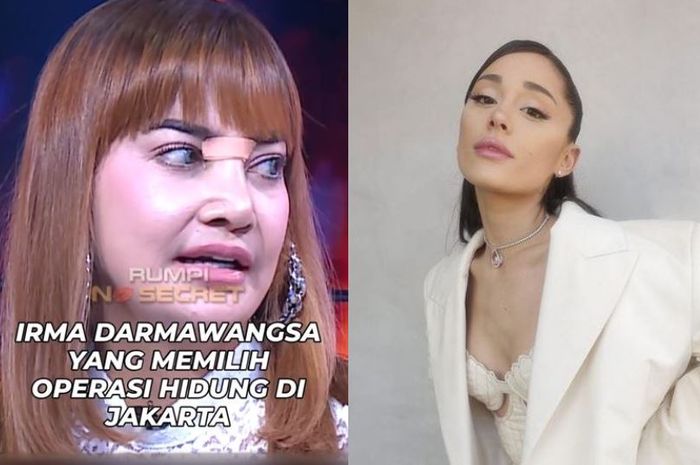 Irma Darmawangsa Oplas di Sunter, Akui Ingin Hidung Seperti Ariana Grande