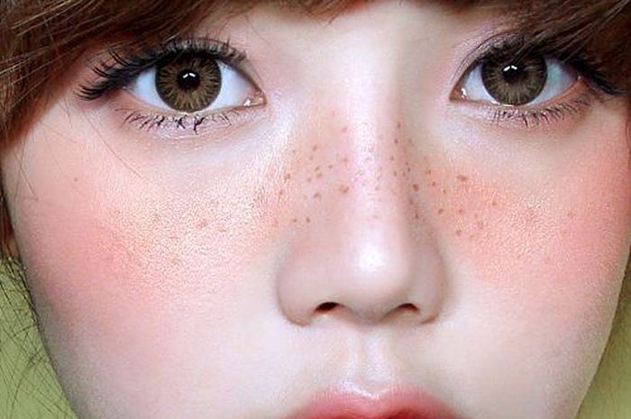 Fakta Tentang Freckles yang Wajib Kita Tahu - CewekBanget