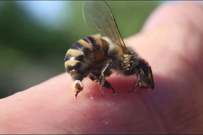 Disengat Lebah, Jangan Khawatir, Inilah 4 Cara yang Ampuh Menyembuhkannya
