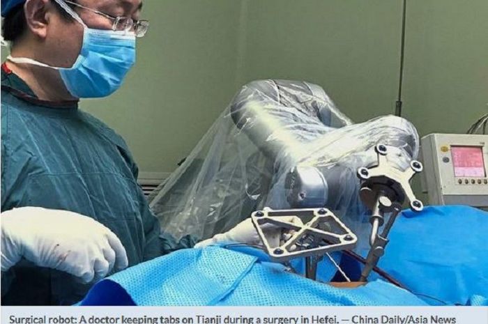 Wow, di Negara Ini, Robot Digunakan untuk Mengoperasi Manusia, Kalau ...