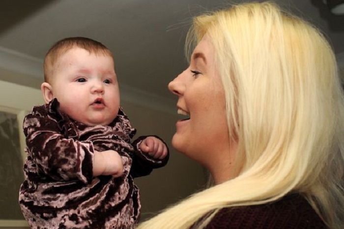 Ngeri, Jahitan Bekas Operasi Caesar Terbuka, Usus Sang Ibu Terburai Keluar