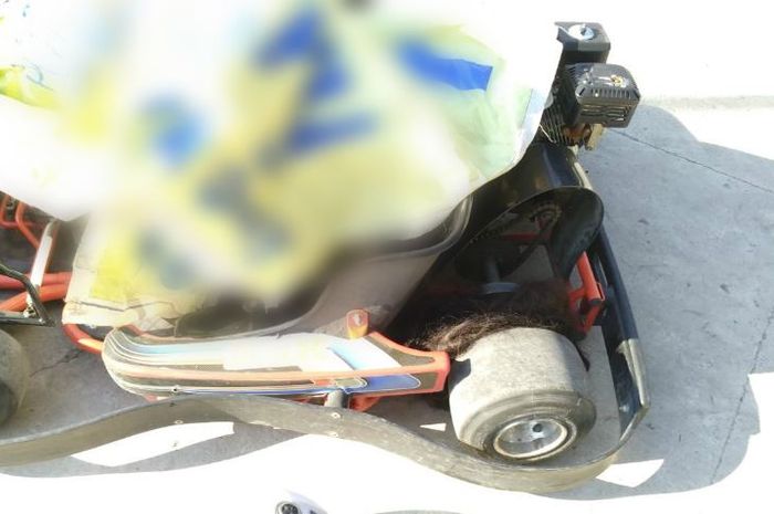 Rambut Panjangnya Tersangkut di Roda Go-Kart, Seorang Wanita Kehilangan ...