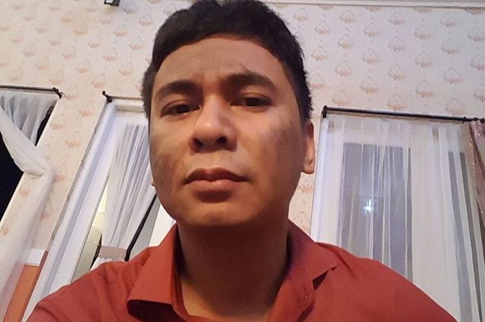 7 Fakta Raditya Dika Ini Bisa Buat Kamu Ternganga!