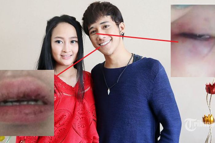 Mulutmu Harimaumu, Satu Kata Inilah Yang Memicu Dicky SMASH Dihajar ...