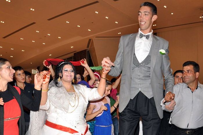 5 Pasangan Paling Unik di Dunia, Nomor 4 Bikin Pengen Lihat Kaca