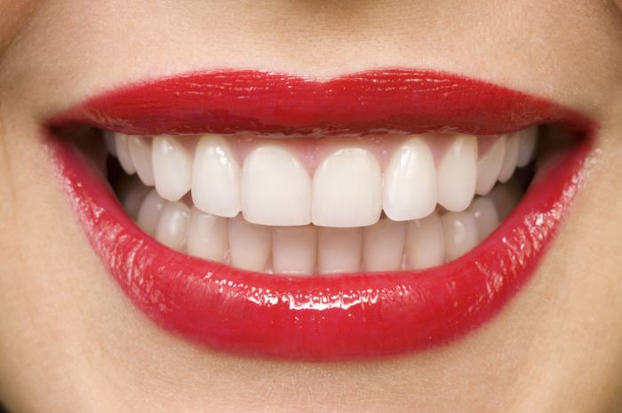 4 Tindakan yang Wajib Kamu Lakukan Kalau Mau Punya Gigi yang Sehat