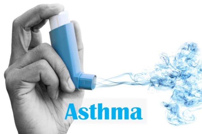 Cegah Asma Sebelum Terlambat! Inilah Daftar Bahan Alami yang Ampuh ...