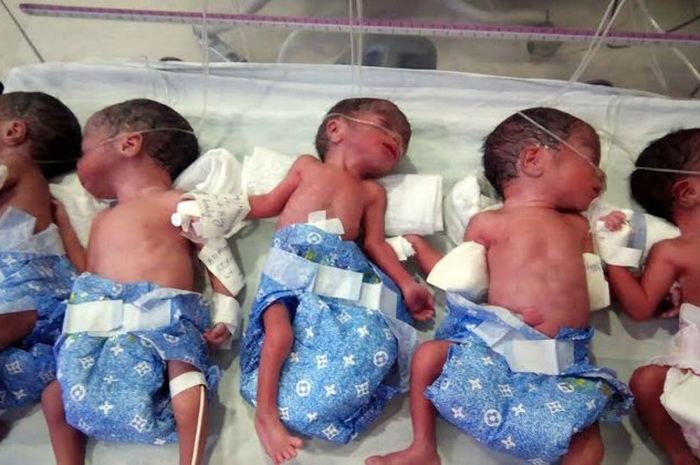 Dikira Hanya Satu, Perempuan India Ini Melahirkan Lima Bayi Kembar ...