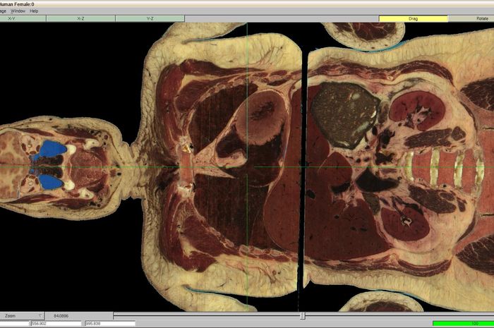 Visible Human Project: Saat Ilmuwan Bangun Manusia Virtual dari 5 Ribu ...