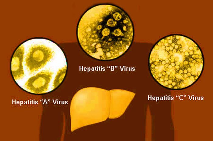 Kenali 5 Jenis Penyakit Hepatitis - Nakita