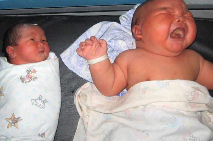 Bayi Besar Berisiko Mengalami Banyak Gangguan Kesehatan - Nakita