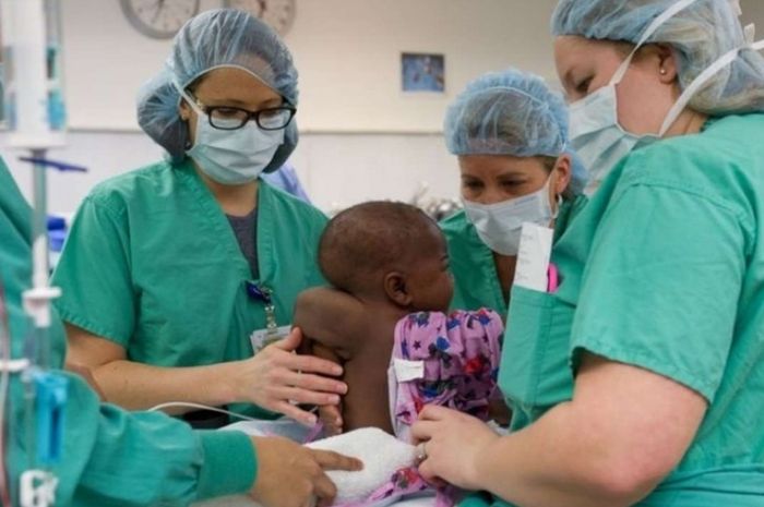 Bayi Usia 10 Bulan Ini Terlahir dengan "Kembar Parasit", Memiliki 4 ...