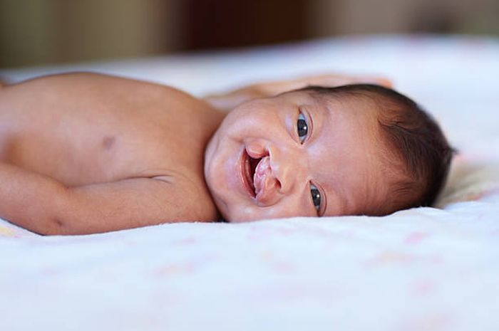 Penyebab Bibir Sumbing Pada Bayi dan Pencegahannya - Nakita Penyebab Bibir Sumbing Pada Bayi dan Pencegahannya - Nakita