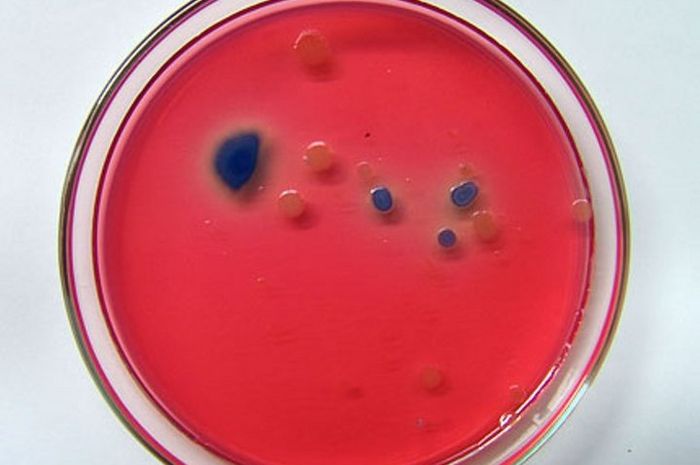 Peneliti simpan data dalam bakteri - National Geographic