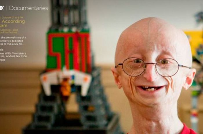 Sam Berns, Penderita Penyakit Langka Meninggal Dunia - National Geographic