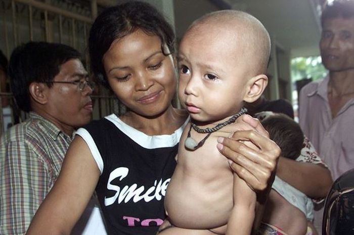 7 Juta Anak Terancam Stunting Akibat Pandemi Corona, Hampir 180 Ribu ... 7 Juta Anak Terancam Stunting Akibat Pandemi Corona, Hampir 180 Ribu ...
