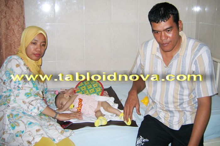 Arteri Bayi Tersayat, Rumah Sakit Lepas Tangan? (2) - Nova