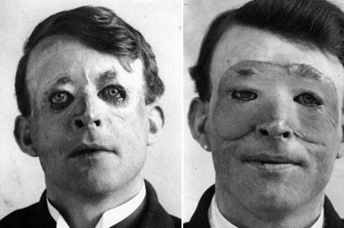 Walter Yeo, Tentara Perang Dunia I yang Disebut sebagai Orang Pertama ...