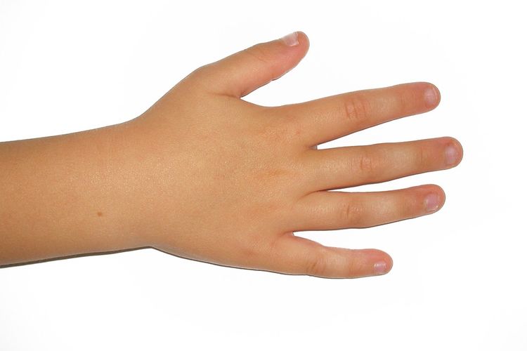 Berita Cubit Tangan Terbaru Hari Ini - Bobo