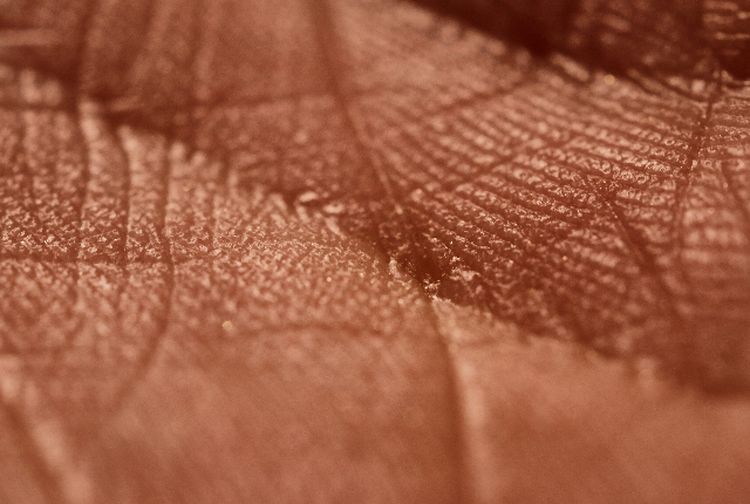 Mengenal 5 Peran Kulit Sebagai Organ Ekskresi Tubuh dan Penjelasannya ...