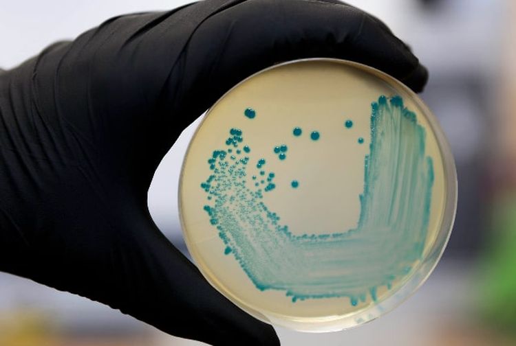 Bioteknologi Konvensional: Pengertian, Ciri-Ciri, serta Penjelasannya ... Bioteknologi Konvensional: Pengertian, Ciri-Ciri, serta Penjelasannya ...