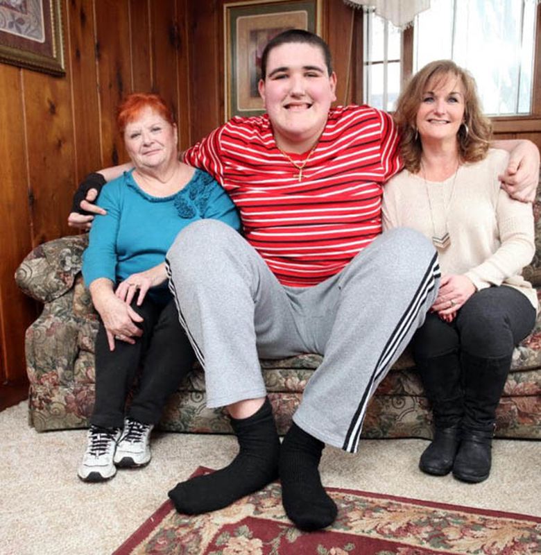 Berita Akromegali Terbaru Hari Ini - Bobo