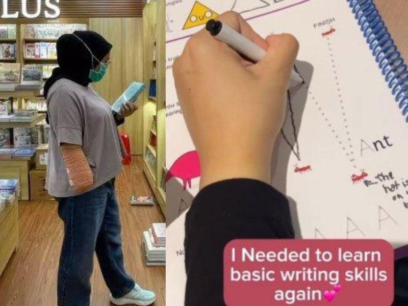 Kronologi Tangan Kanan Putri Harry Kahitna Diamputasi Akibat Kecelakaan ...