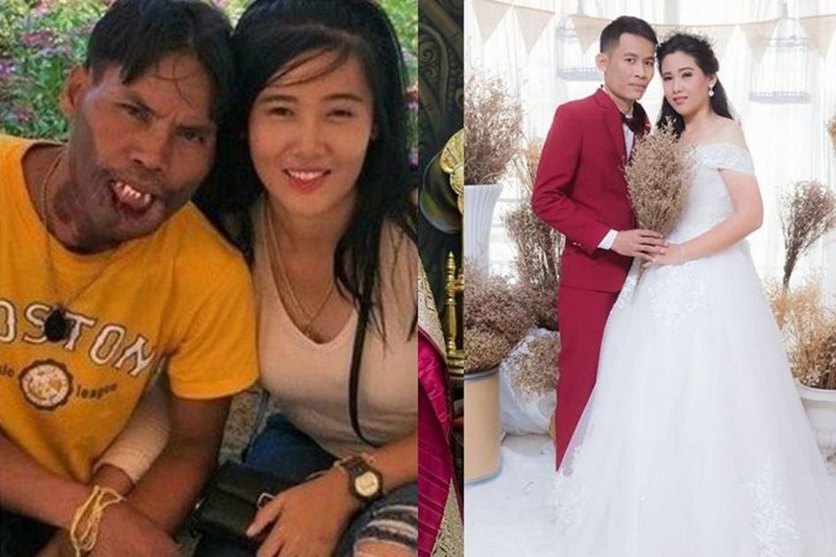 Berita Buruk Rupa Terbaru Hari Ini - Grid.ID